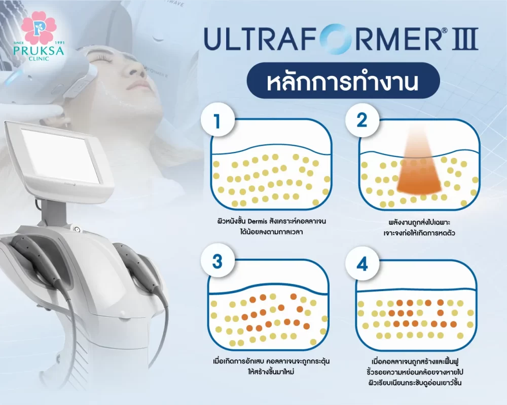 ULTRAFORMER III & ULTRAFORMER MPT - pruksaclinic