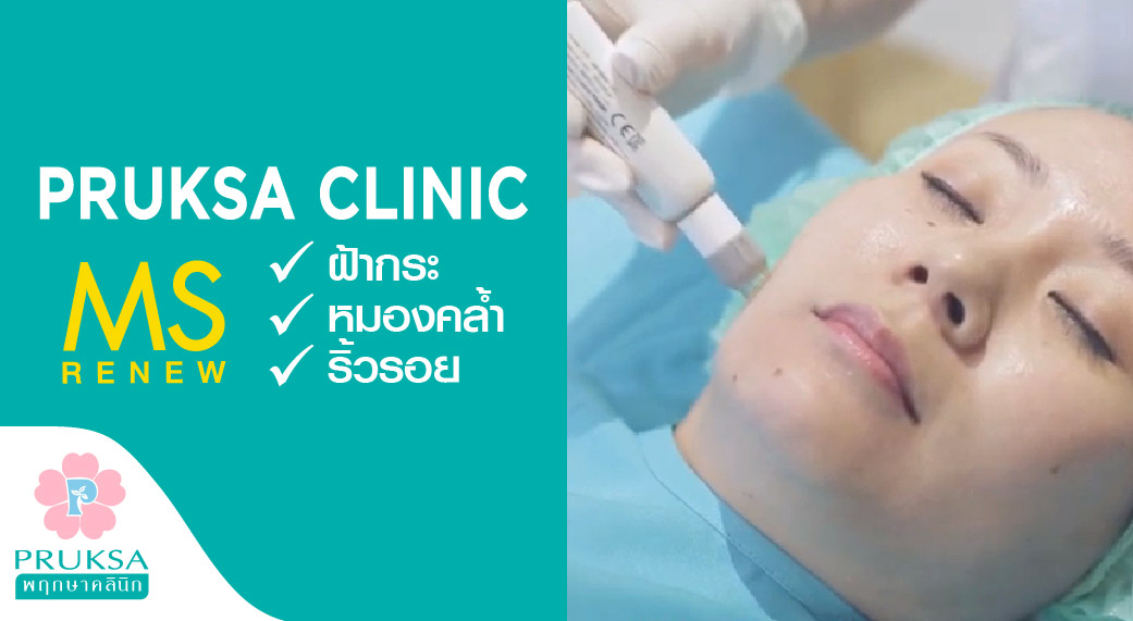 Meso Renew Program (โปรแกรม เมโส รีนิว) - pruksaclinic