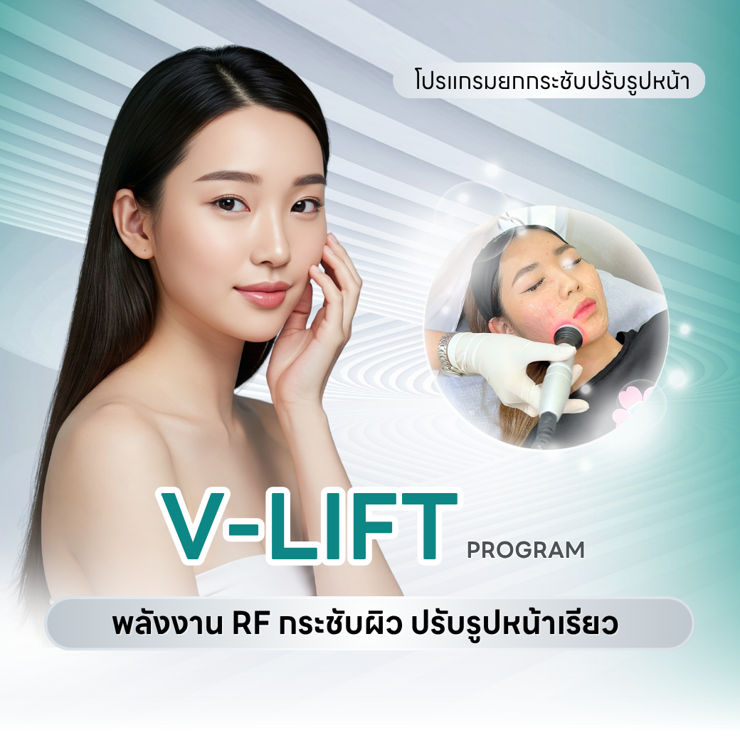 V-Lift program กระชับผิว ปรับรูปหน้าเรียว - pruksaclinic