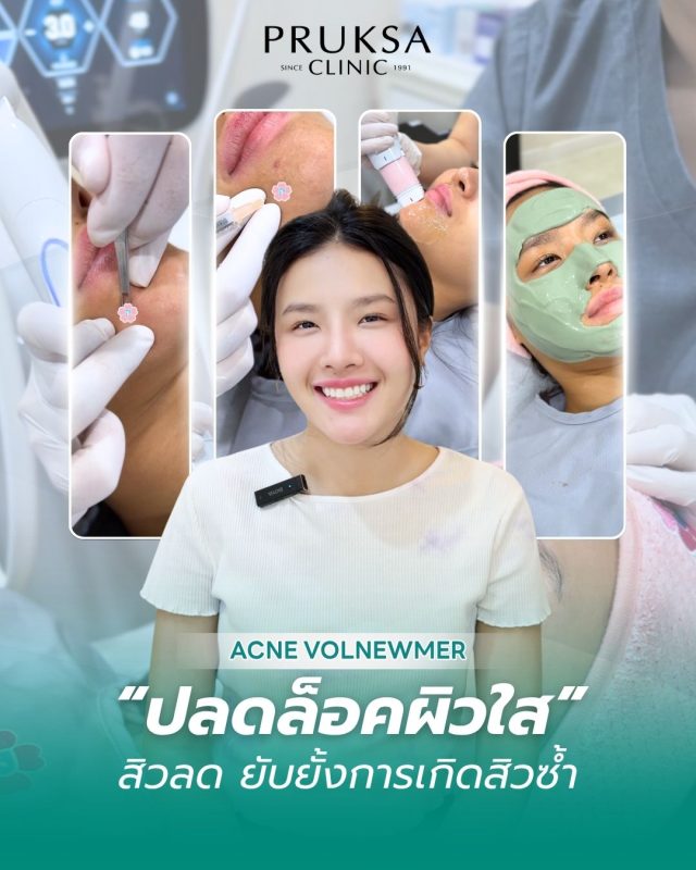 Acne Volnewmer Program - pruksaclinic